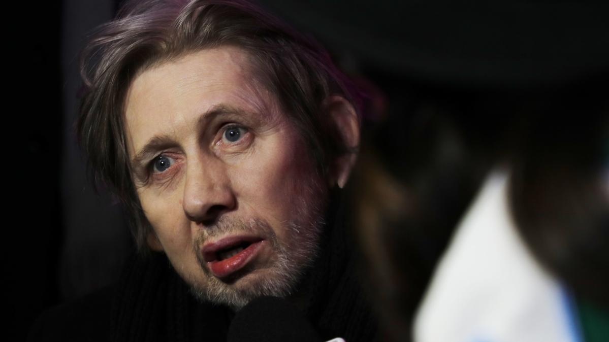 Shane Macgowan New Teeth