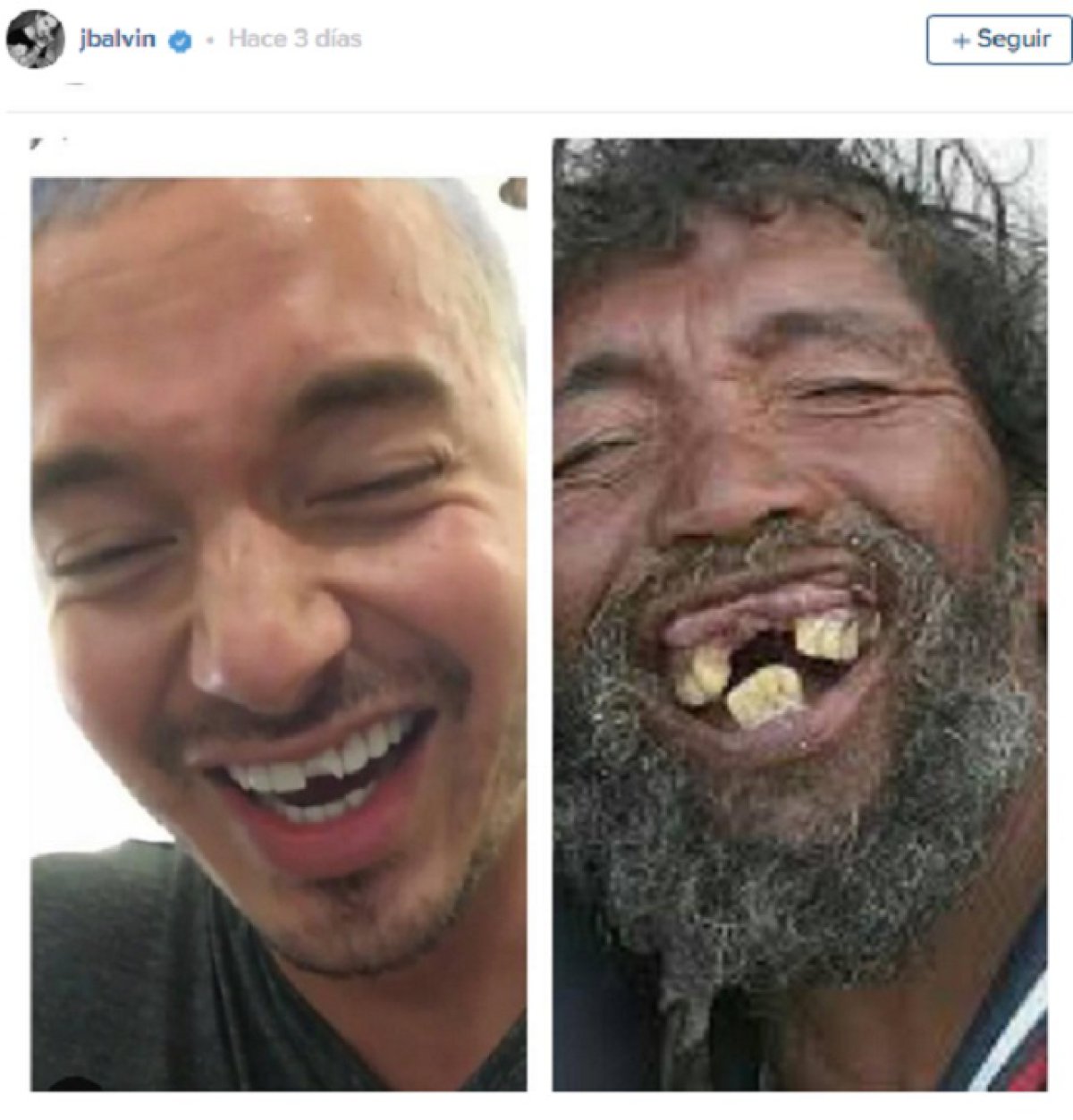 Dientes Feos Memes Humor Más Que Dientes
